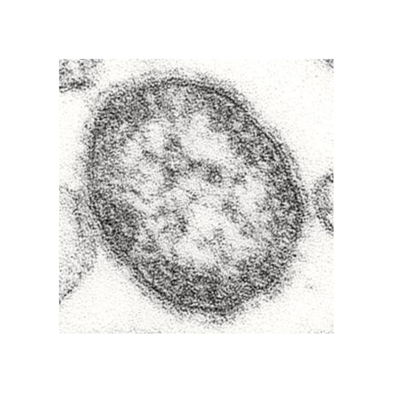 Rougeole: les stratégies gagnantes du virus | Agence Science-Presse