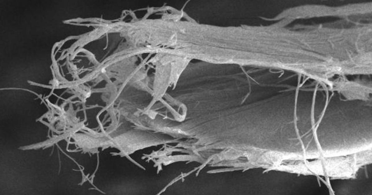 L'amiante et ses normes | Agence Science-Presse