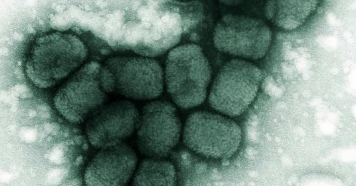 Retour aux origines de la variole | Agence Science-Presse