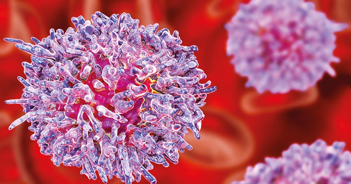 Démêler les gènes pour soigner une leucémie | Agence Science-Presse