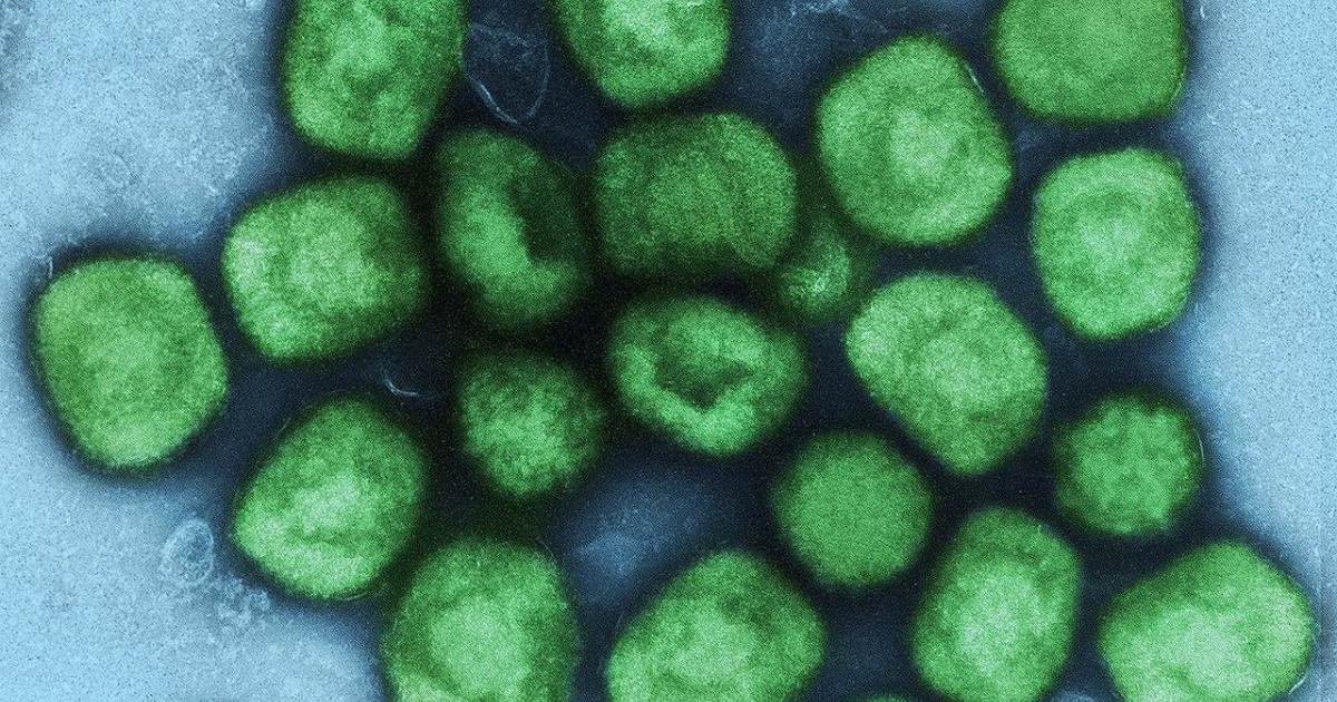 Variole du singe et vaccination en anneau | Agence Science-Presse