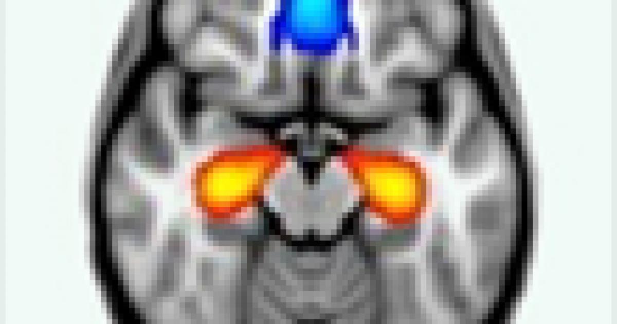 La conscience humaine : son «expansion», sa «localisation»… | Agence ...