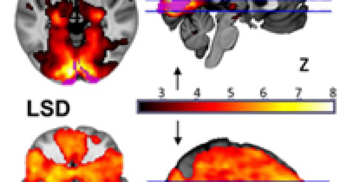 Une première étude d’imagerie cérébrale sur les effets du LSD | Agence ...